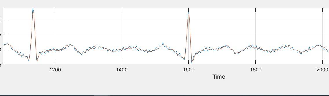 Solved I have filtered the ECG signal on MATLAB using fast | Chegg.com