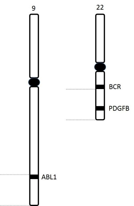 Philadelphia Syndrome occurs when the distal segments | Chegg.com