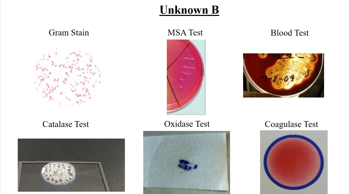 12 steps for Identification of Unknown "Bacteria” Lab | Chegg.com