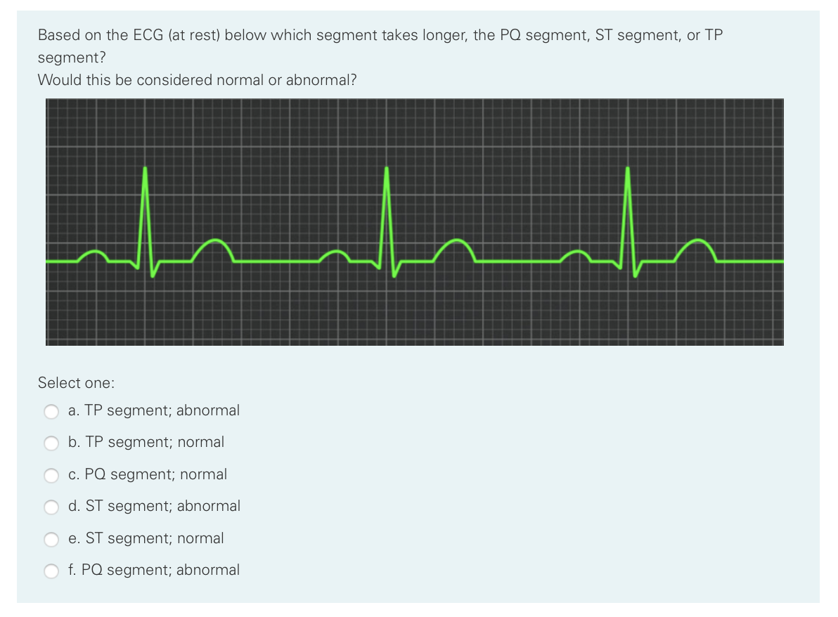 Solved Based on the ECG (at rest) below which segment takes | Chegg.com
