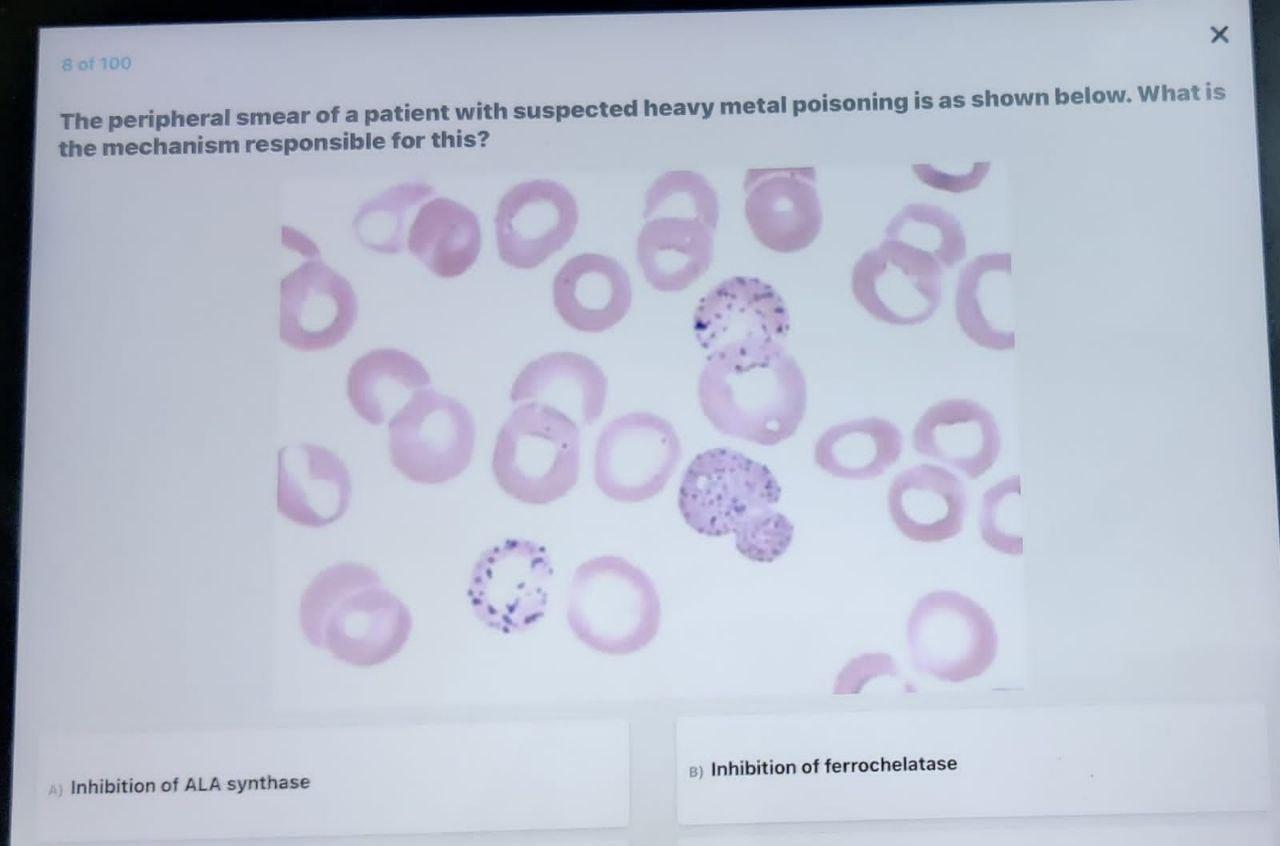 Solved 8 of 100 The peripheral smear of a patient with | Chegg.com