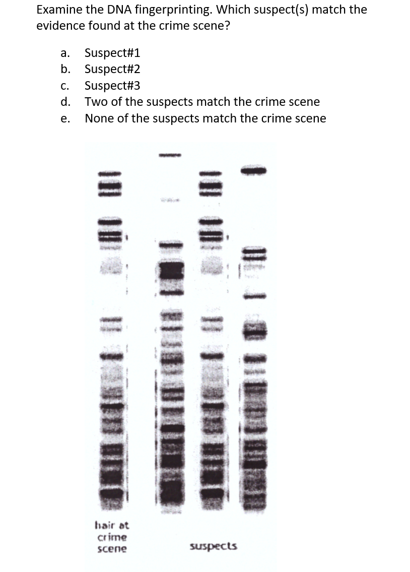 Examine the DNA fingerprinting. Which suspect(s) | Chegg.com