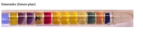 Solved Above are Results of EnteroPluri Test for an | Chegg.com