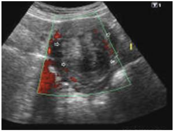 Solved Describe the sonographic appearance and identify the | Chegg.com