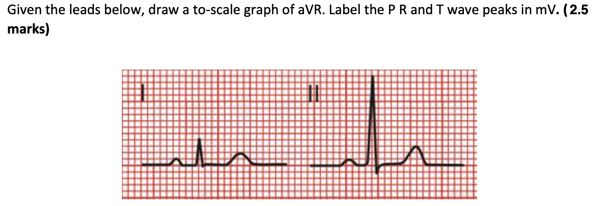 Solved Given the leads below, draw a to-scale graph of aVR. | Chegg.com