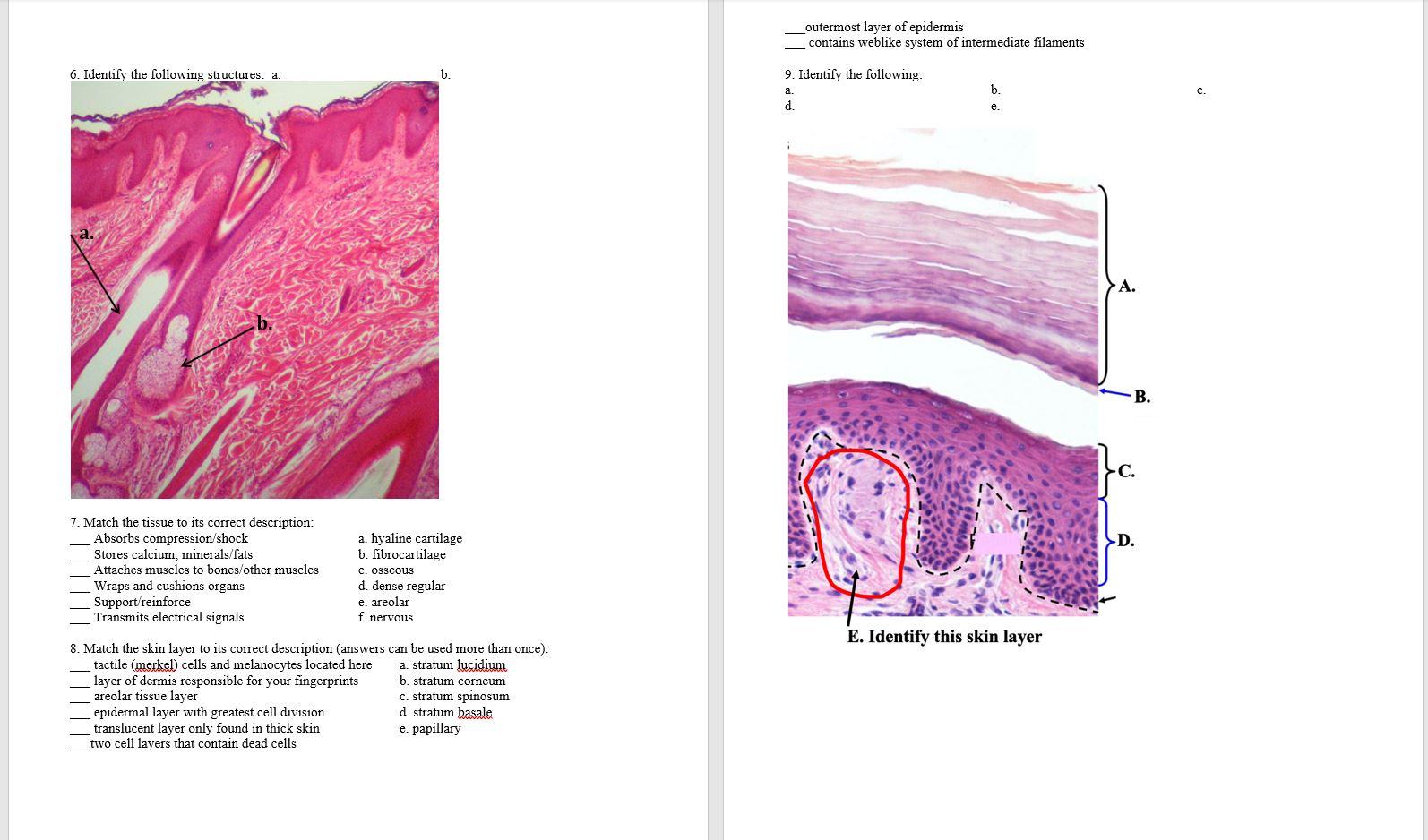 Solved outermost layer of epidermis contains weblike system | Chegg.com