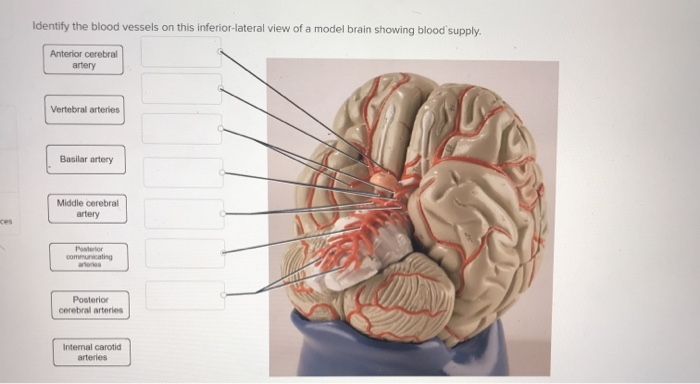 Solved Identify the blood vessels on this inferior-lateral | Chegg.com
