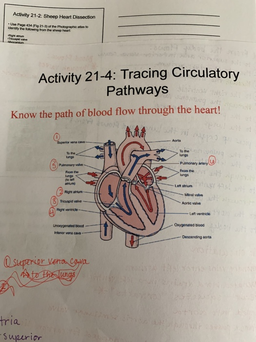 Solved could someone please number the pathway of blood | Chegg.com