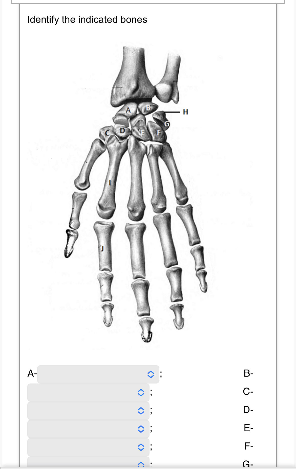 Solved Identify the indicated bones Word bank 1 calcaneus | Chegg.com