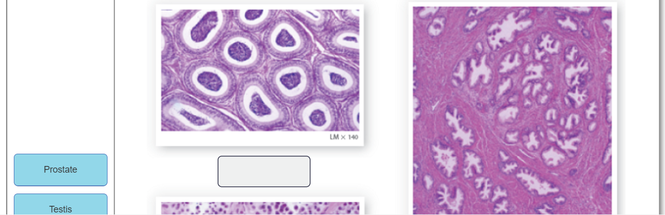 Solved Prostate Testis Epididymis LM X 175 LM X 245 LM X | Chegg.com