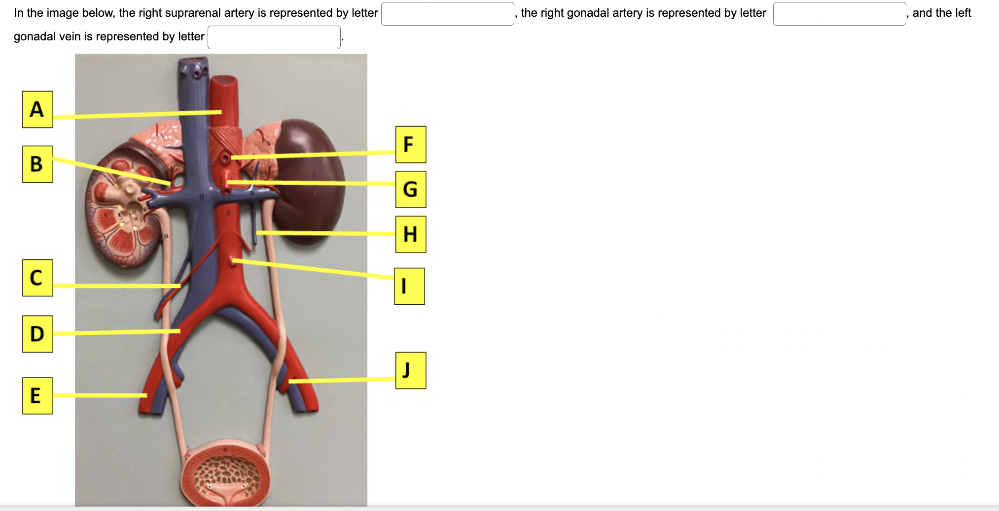 Solved In the image below, the right suprarenal artery is | Chegg.com