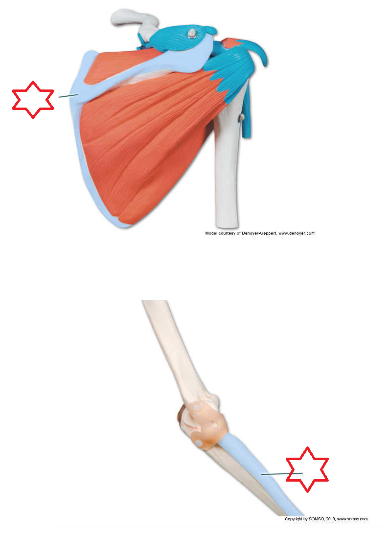 Solved Top Image: Which bone is highlighted? A:) | Chegg.com