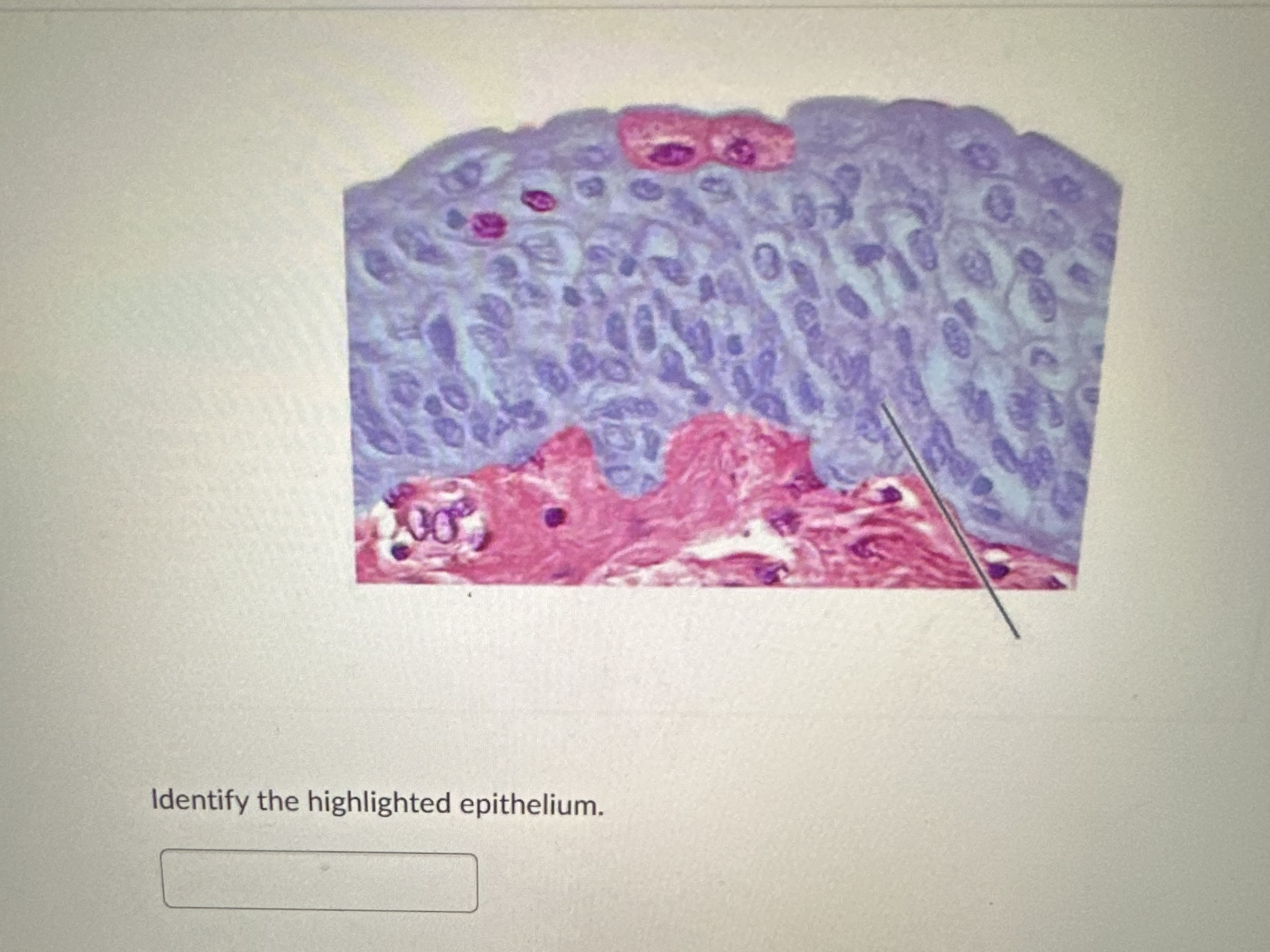 Solved Identify the highlighted epithelium. | Chegg.com