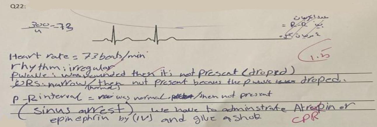 Solved 4300−73 Heart rate rhythm:irregular pwowe: | Chegg.com