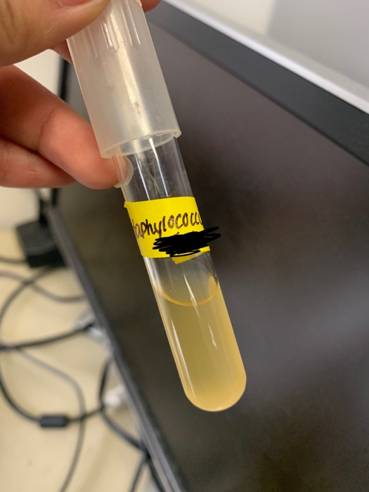 Solved Aseptic Techniques Your Results and Observations 1. | Chegg.com Solved Aseptic Techniques Your Results and Observations 1. | Chegg.com