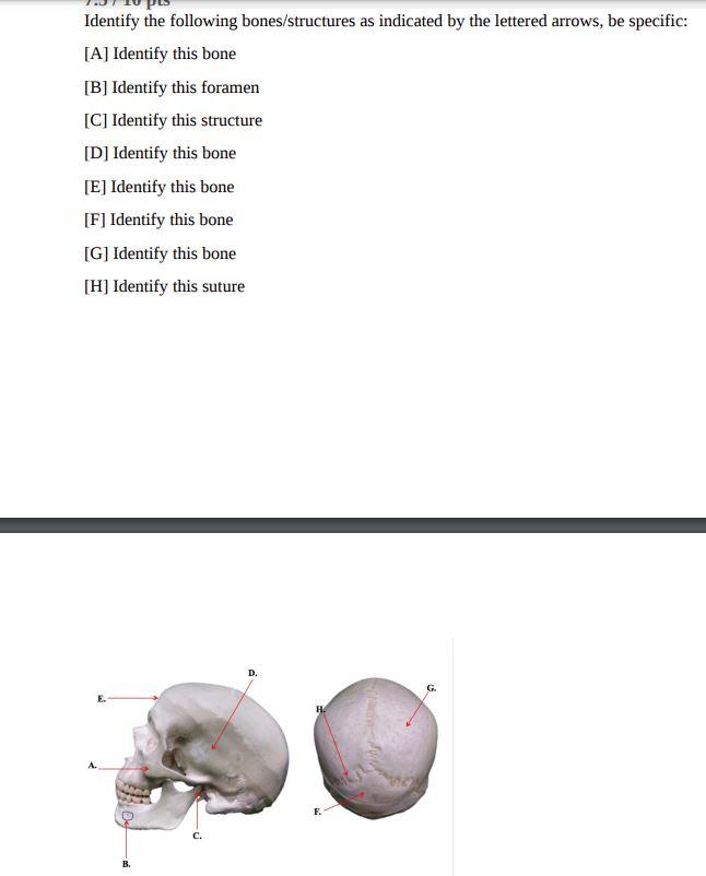 Solved Identify the following bones/structures as indicated | Chegg.com