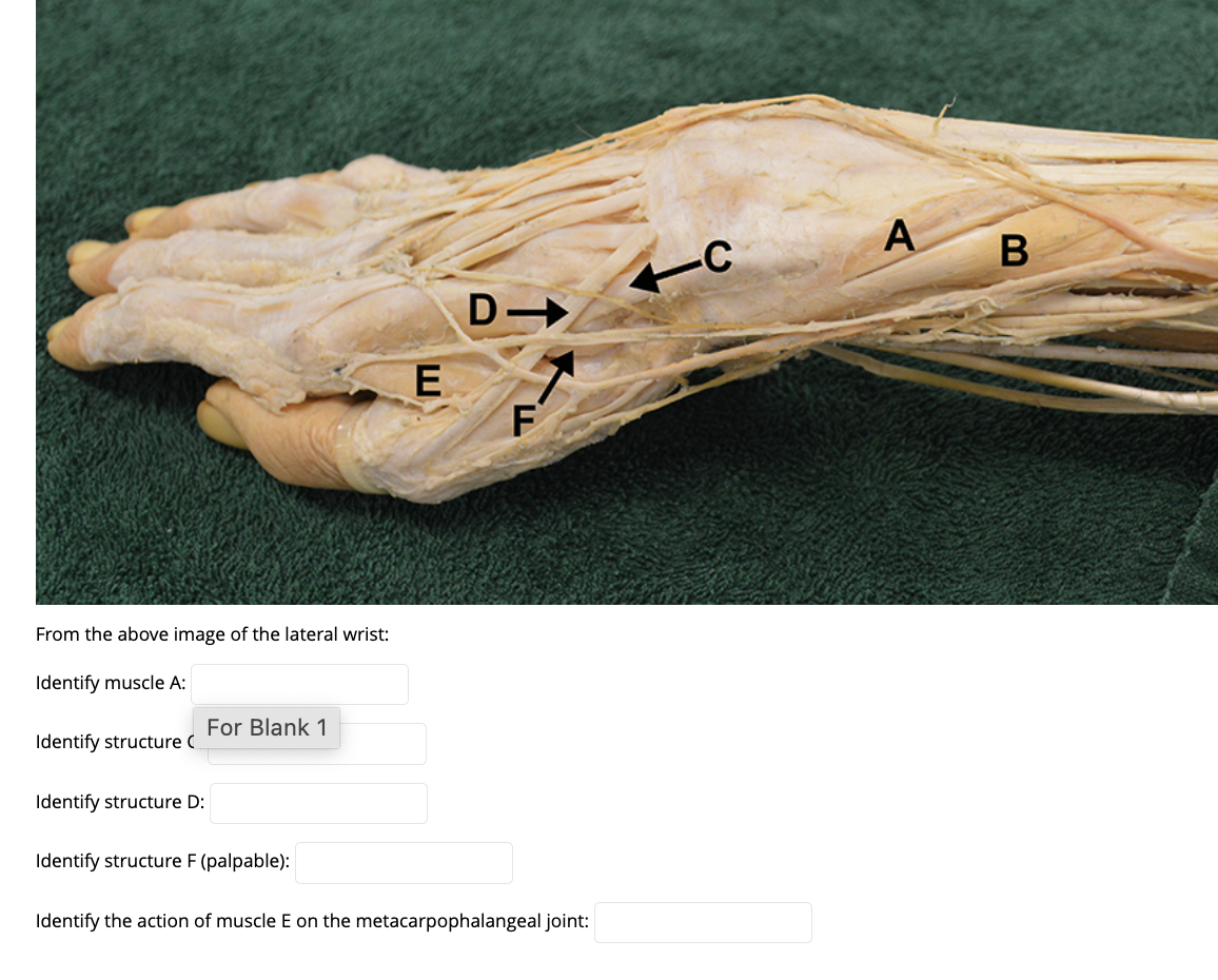 Solved From the above image of the lateral wrist: Identify | Chegg.com