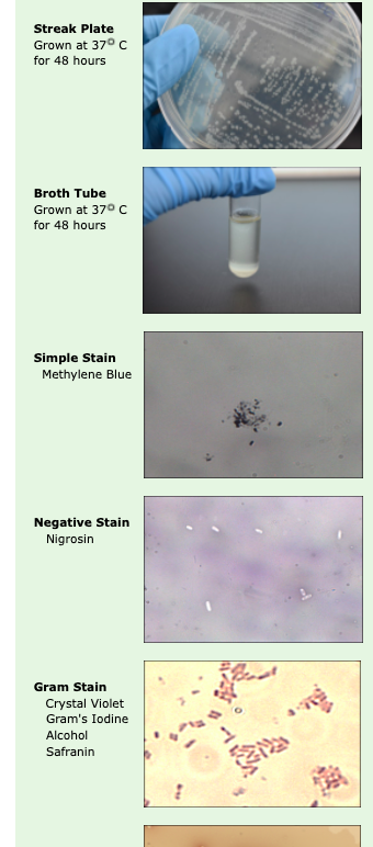 Solved Starch Agar + Iodine Blood Agar Catalase Test + | Chegg.com