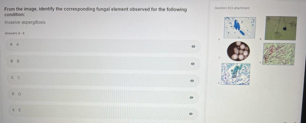 [Solved]: From the image, identify the corresponding funga