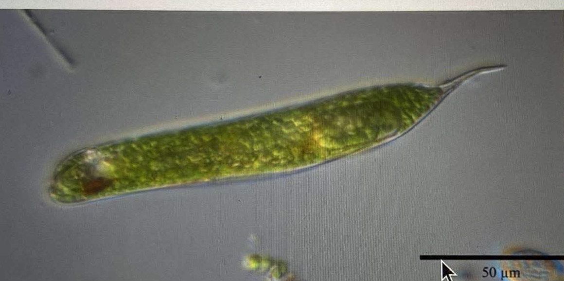 Solved Identify the type of protist and the phylum it | Chegg.com