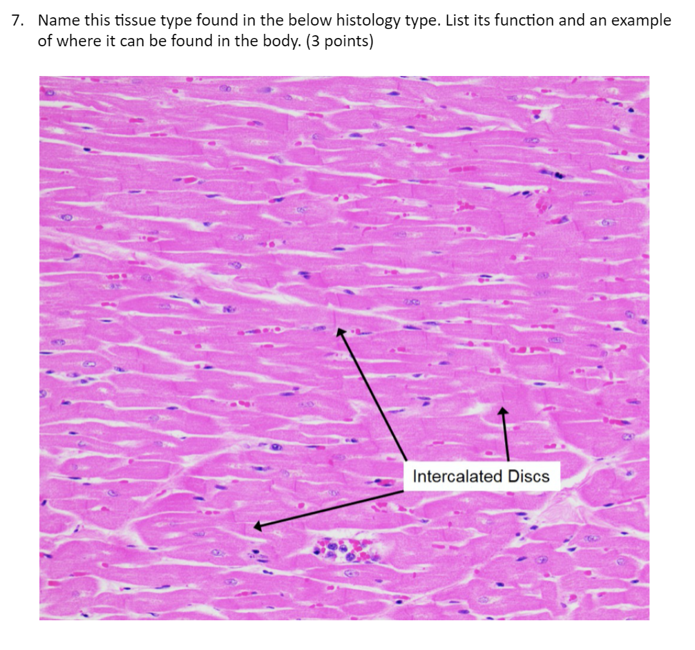 Solved 5. Name this tissue type found in the below histology | Chegg.com