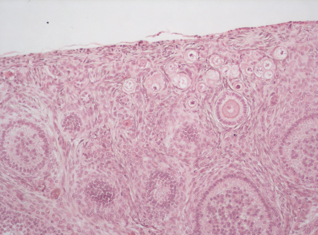 Solved Rabbit ovary (cross section; staining: | Chegg.com