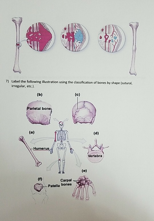 5) Label the following types fractures: 6) Label each | Chegg.com