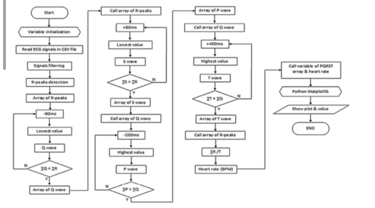 Solved Write MATLAB code to detect and mark PQRST complex of | Chegg.com