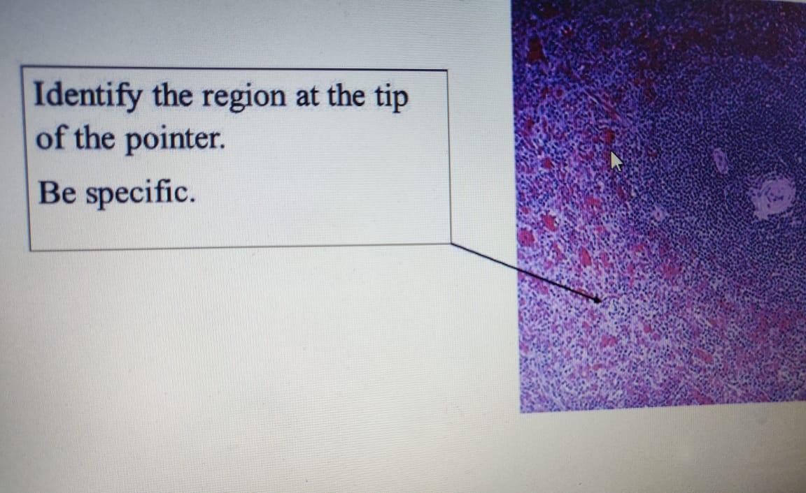 Solved Identify the region & organ at ti tip of the pointer. | Chegg.com