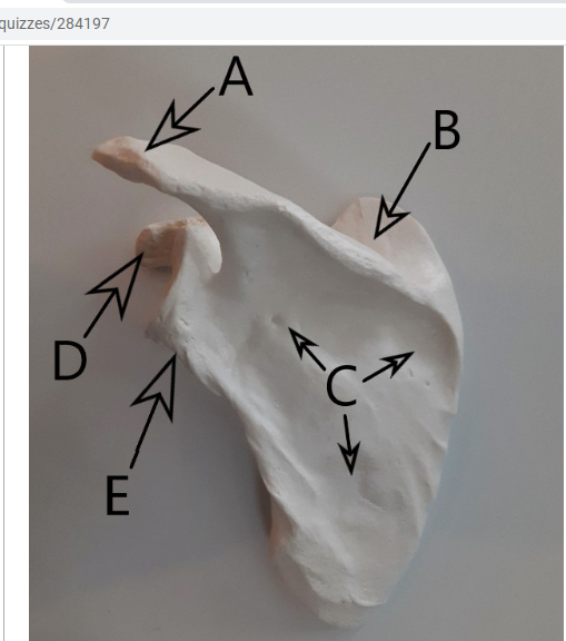 Solved The structure indicated by "A" is [ Select ] | Chegg.com