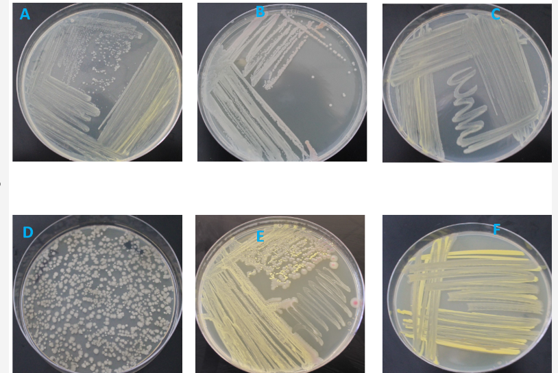 1. Which of these plates is the best for isolating | Chegg.com