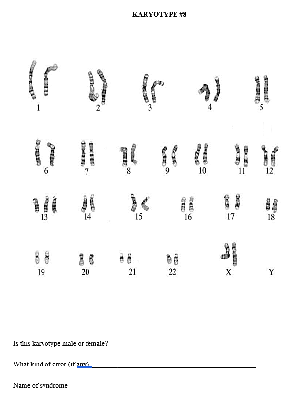 Solved Is this karyotype male or female? What kind of error | Chegg.com