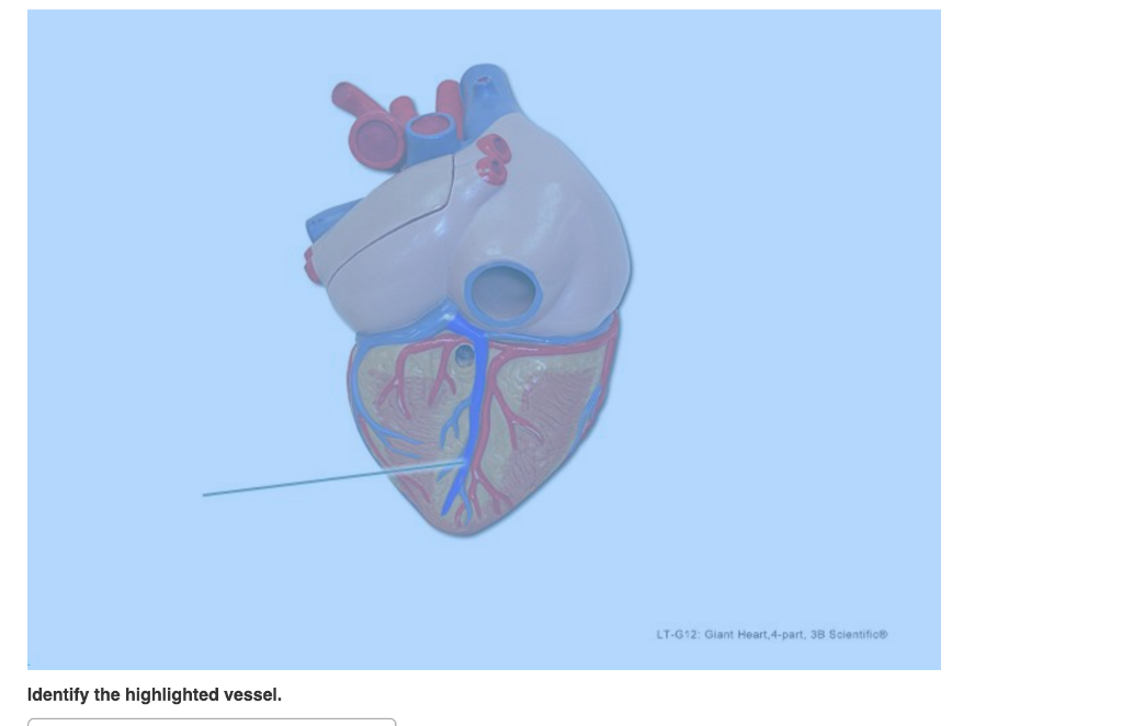 Solved Identify the highlighted vessel. LT-G12: Giant Heart, | Chegg.com