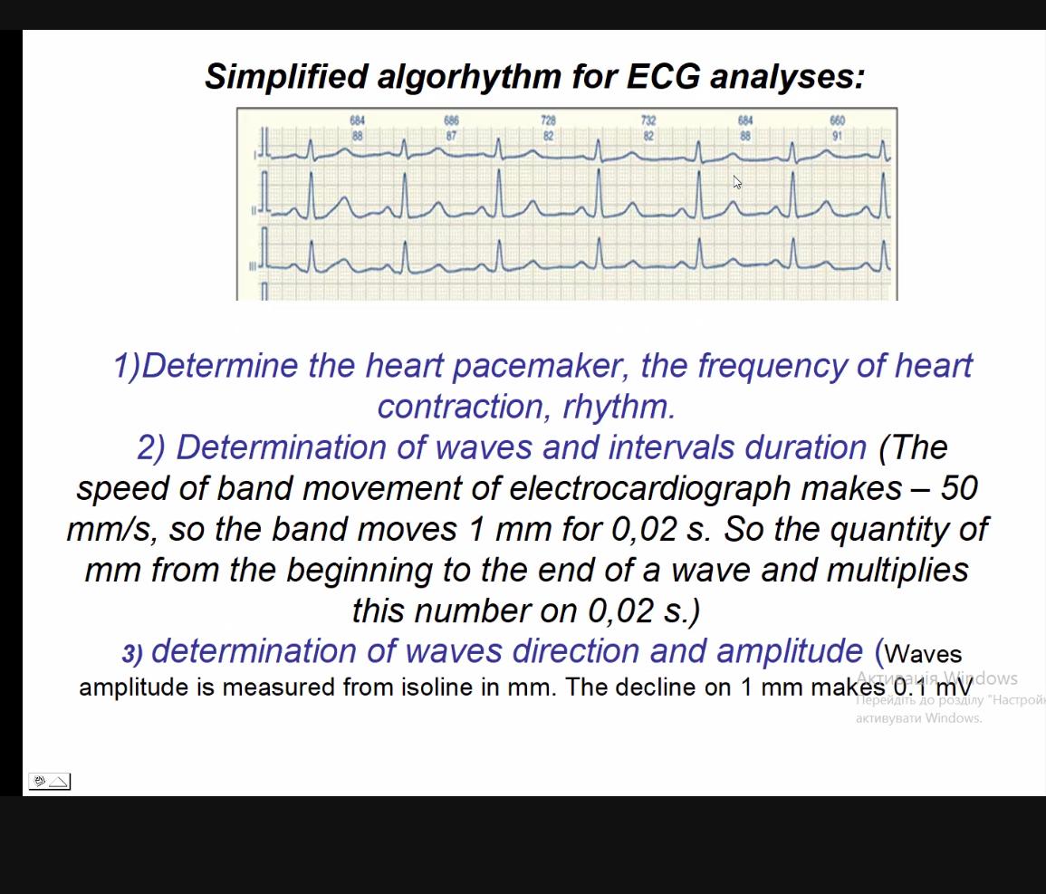 Solved Simplified algorhythm for ECG analyses: 1)Determine | Chegg.com