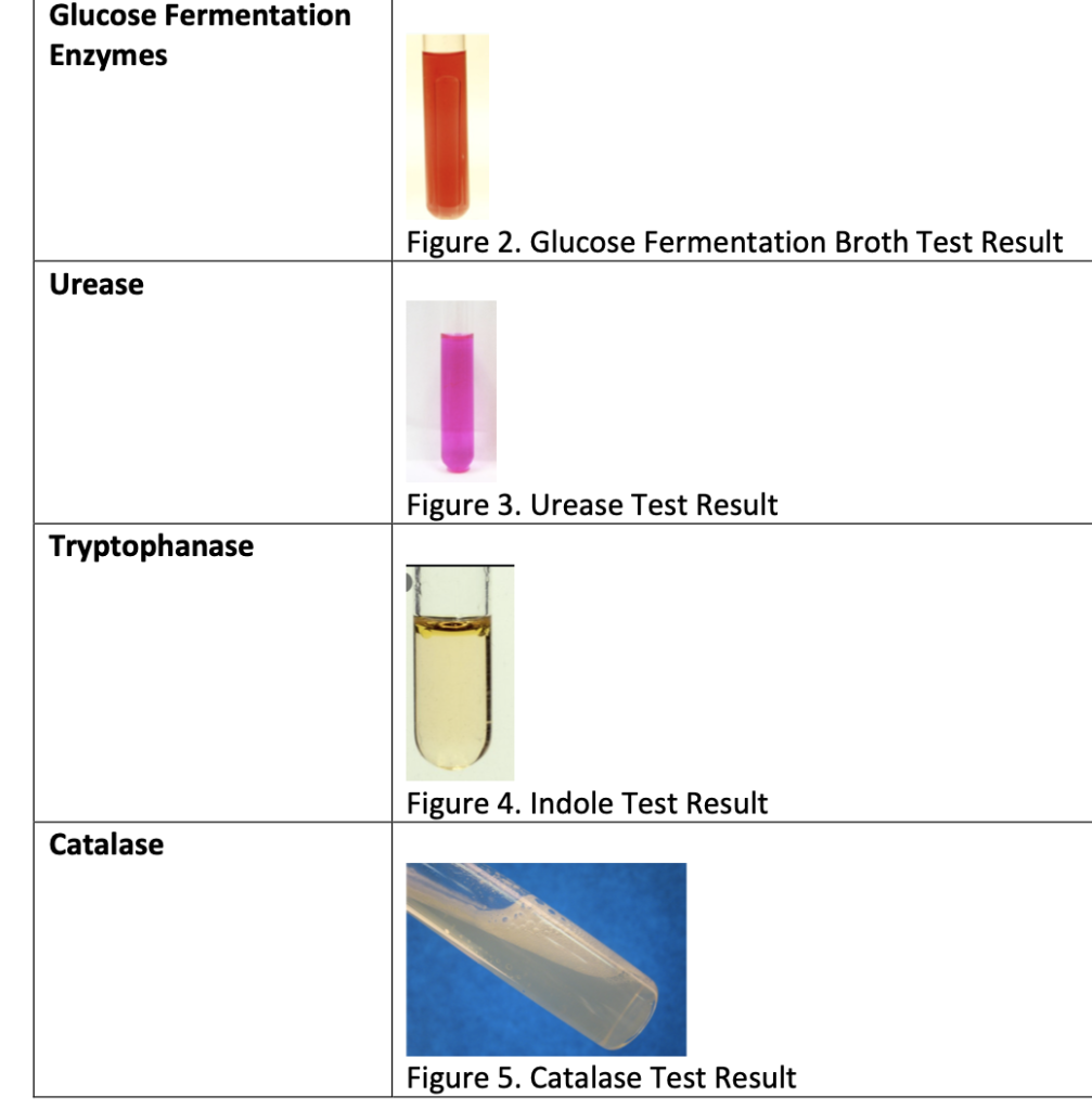 Solved Interpret the following test results in Table | Chegg.com