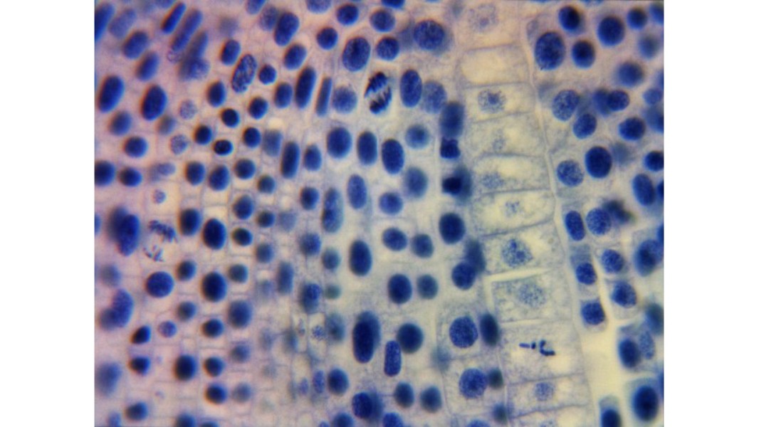 Solved Locate a cell undergoing the G2 phase of | Chegg.com