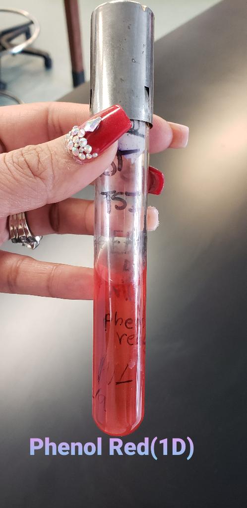 Solved , Methy Red WL 20 TSI(1 day) WL Citrate (1D) | Chegg.com