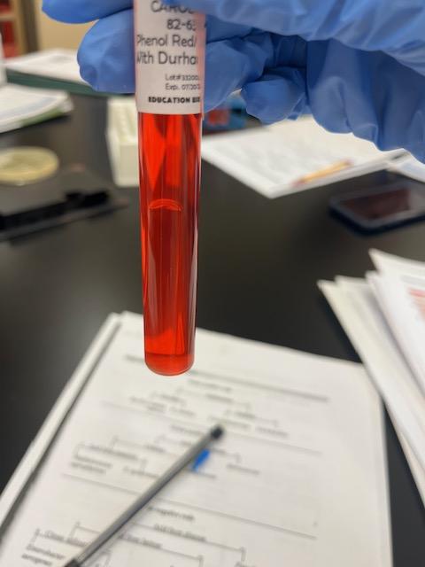 Solved What unknown organism is this? Catalase test is | Chegg.com