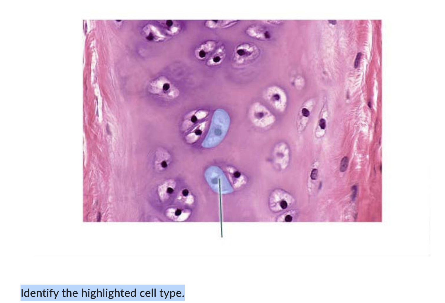 Solved Identify the highlighted cell type. | Chegg.com Solved Identify the highlighted cell type. | Chegg.com