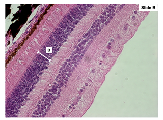 Solved For slides A and B, identify the indicated layer or | Chegg.com