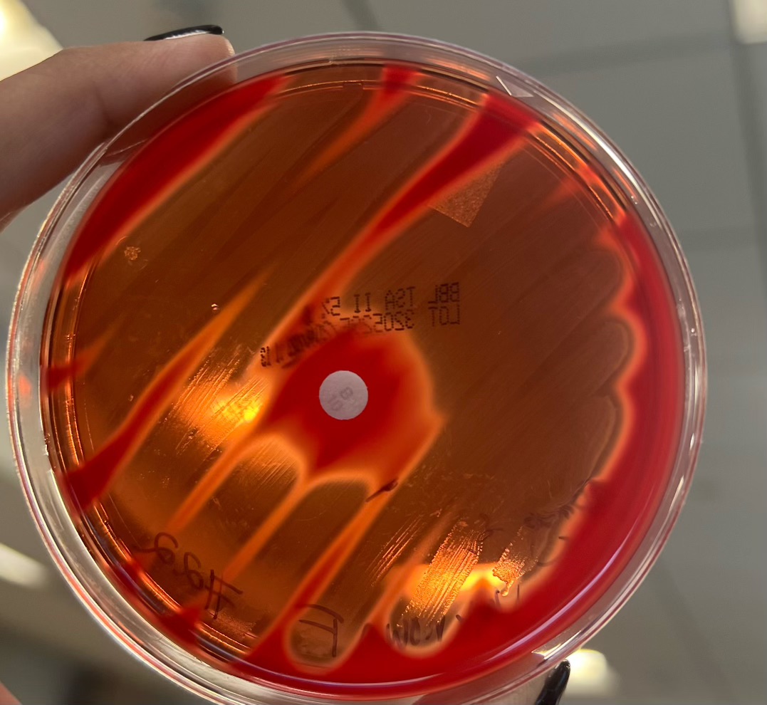Solved I know that the strep above is positive for beta | Chegg.com