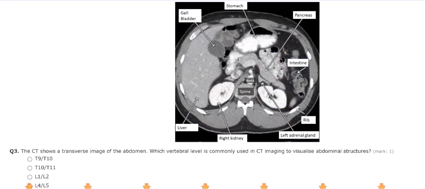 Solved Stomach Gall Bladder Pancreas Intestine Aorta Spine | Chegg.com