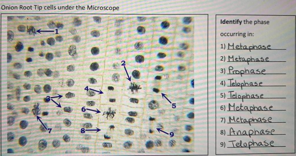 Solved Onion Root Tio cells under the Microscone Identify | Chegg.com