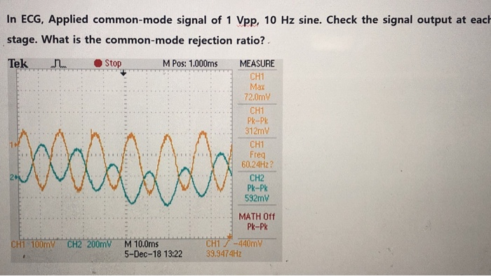 In ECG, Applied common-mode signal of 1 Vpp, 10 Hz | Chegg.com