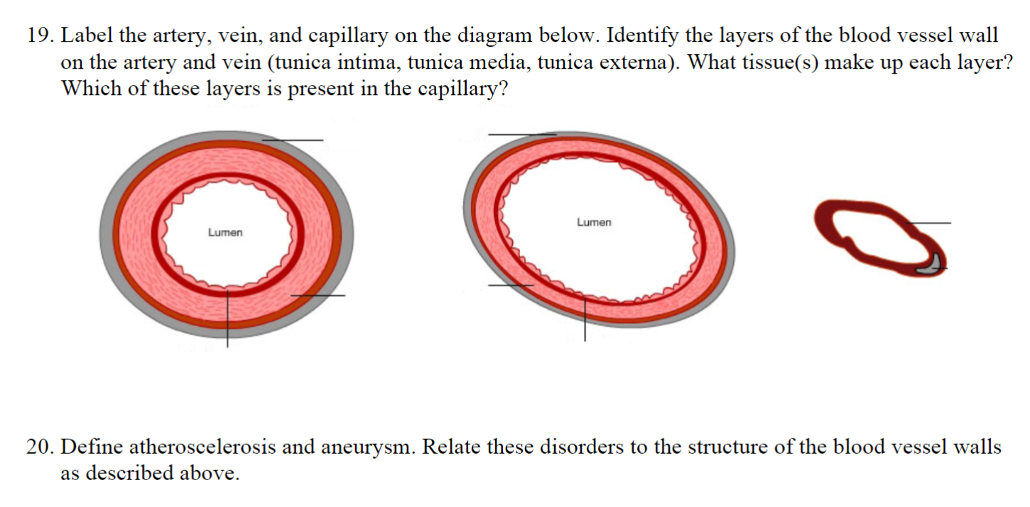 Solved 19. Label the artery, vein, and capillary on the | Chegg.com