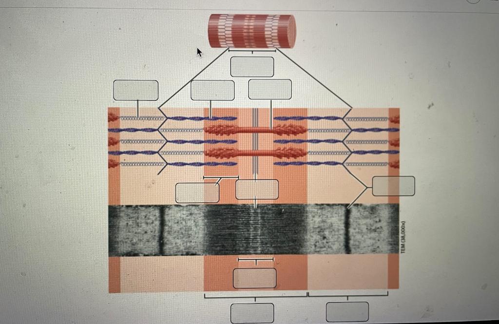 Solved ho Z-disc Elastic filament I band Sarcomere A band H | Chegg.com