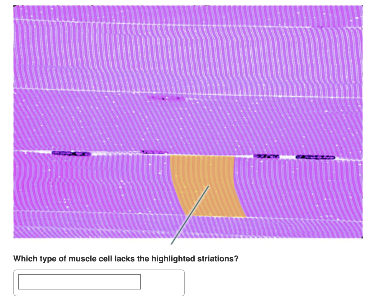 Solved Which type of muscle cell lacks the highlighted | Chegg.com