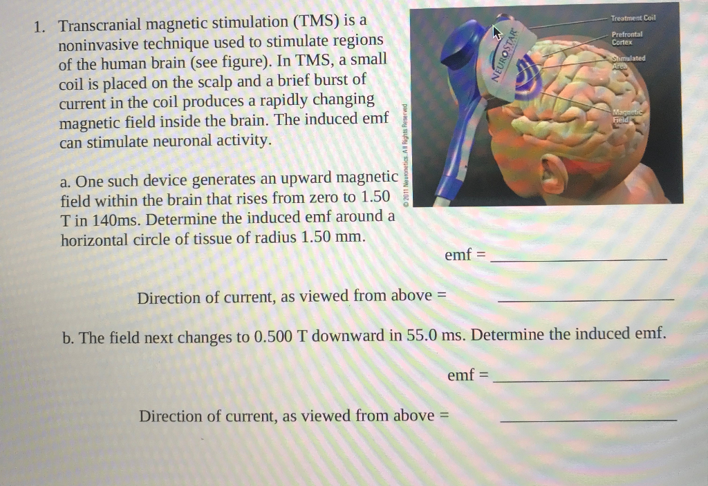 Solved Treatment Coil 1. Transcranial magnetic stimulation | Chegg.com