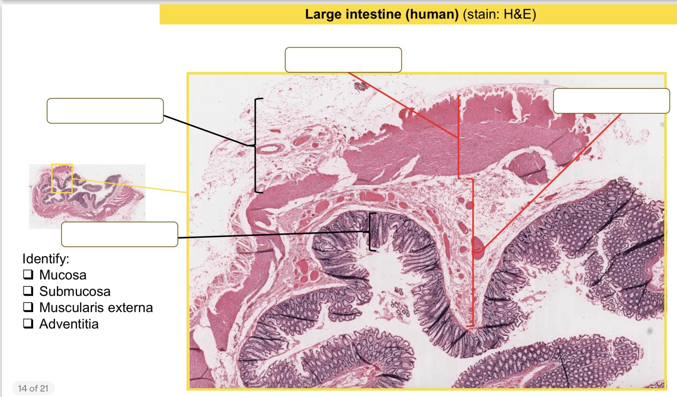 Solved Large intestine (human) (stain: H\&E)Small intestine | Chegg.com