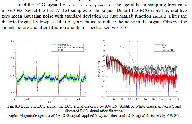 Load the ECG signal by load('ecgsig.mat"). The signal | Chegg.com
